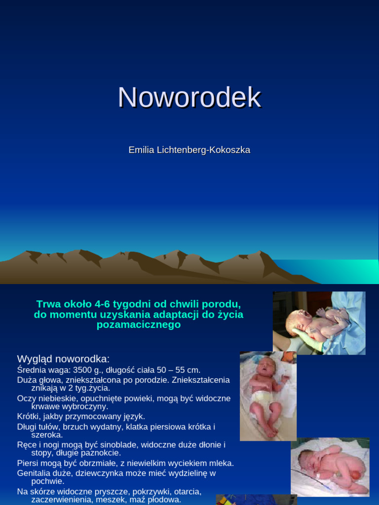 Noworodek | PDF