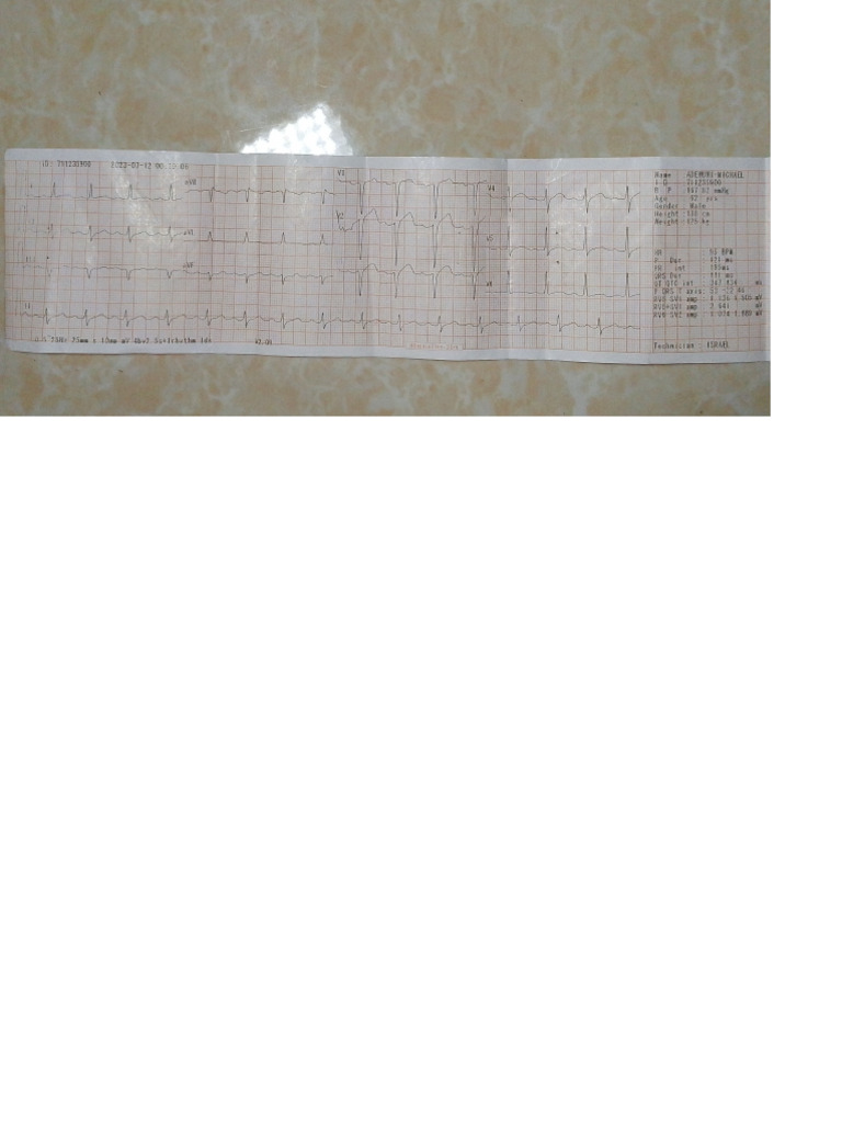 ECG Result 1. | PDF