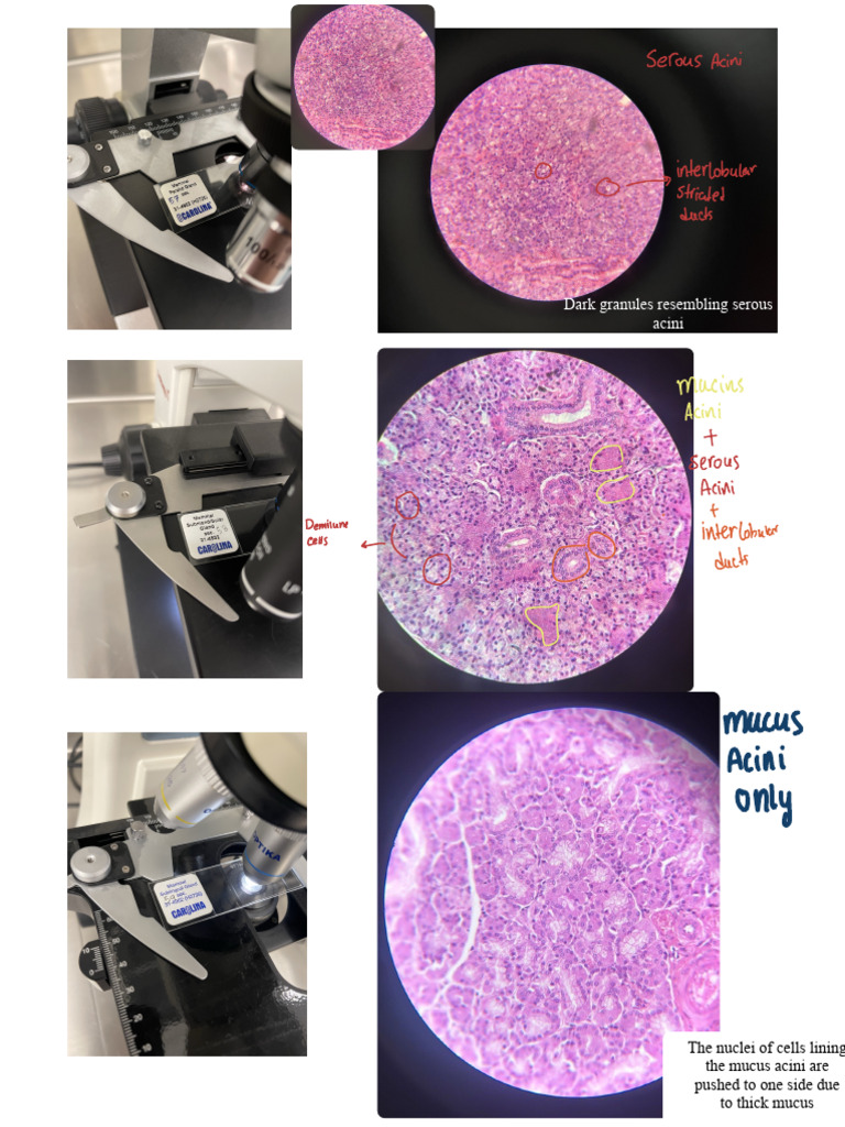 Anatomy of Serous and Mucus Acini | PDF