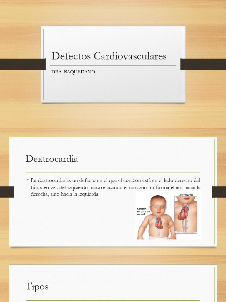 4 Defectos Cardiovasculares | PDF | Corazón | Sistema circulatorio