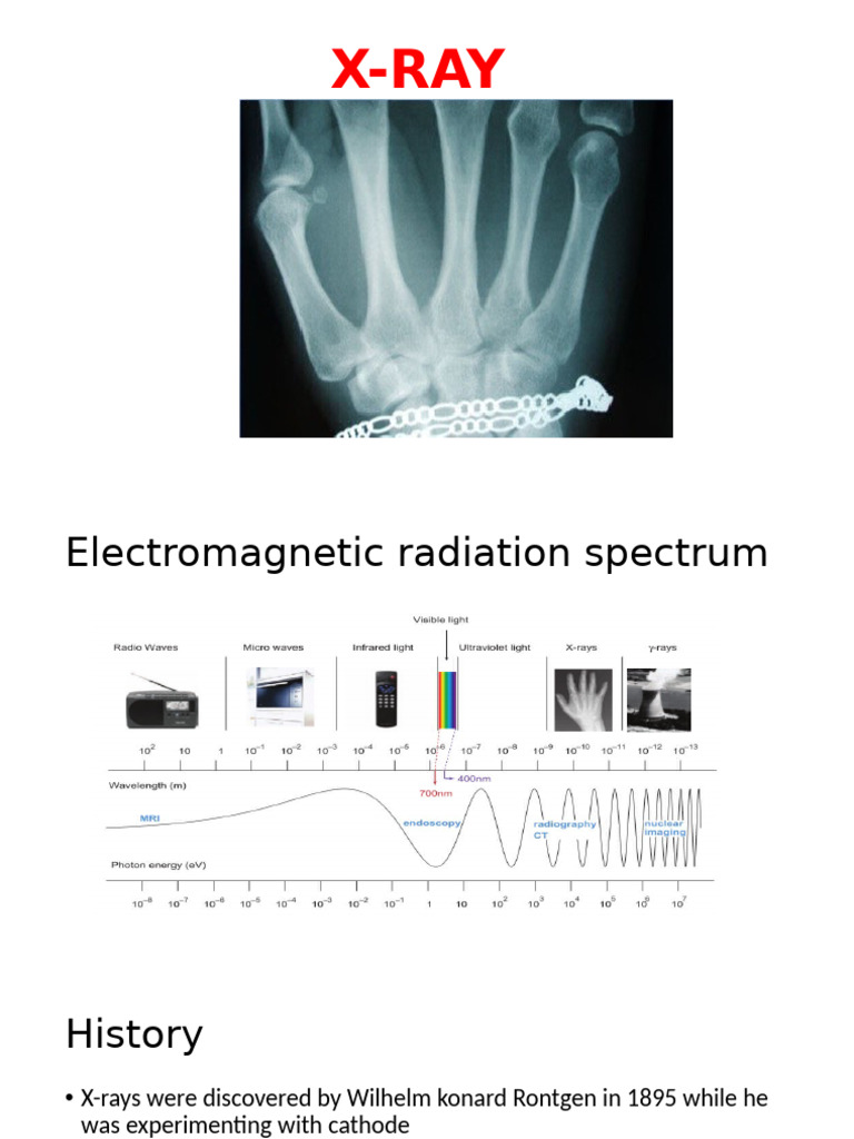 X Ray | PDF | Transformer | X Ray
