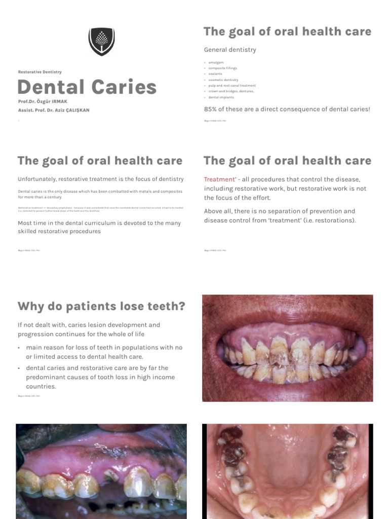 Understanding Dental Caries | PDF | Dentistry | Human Tooth