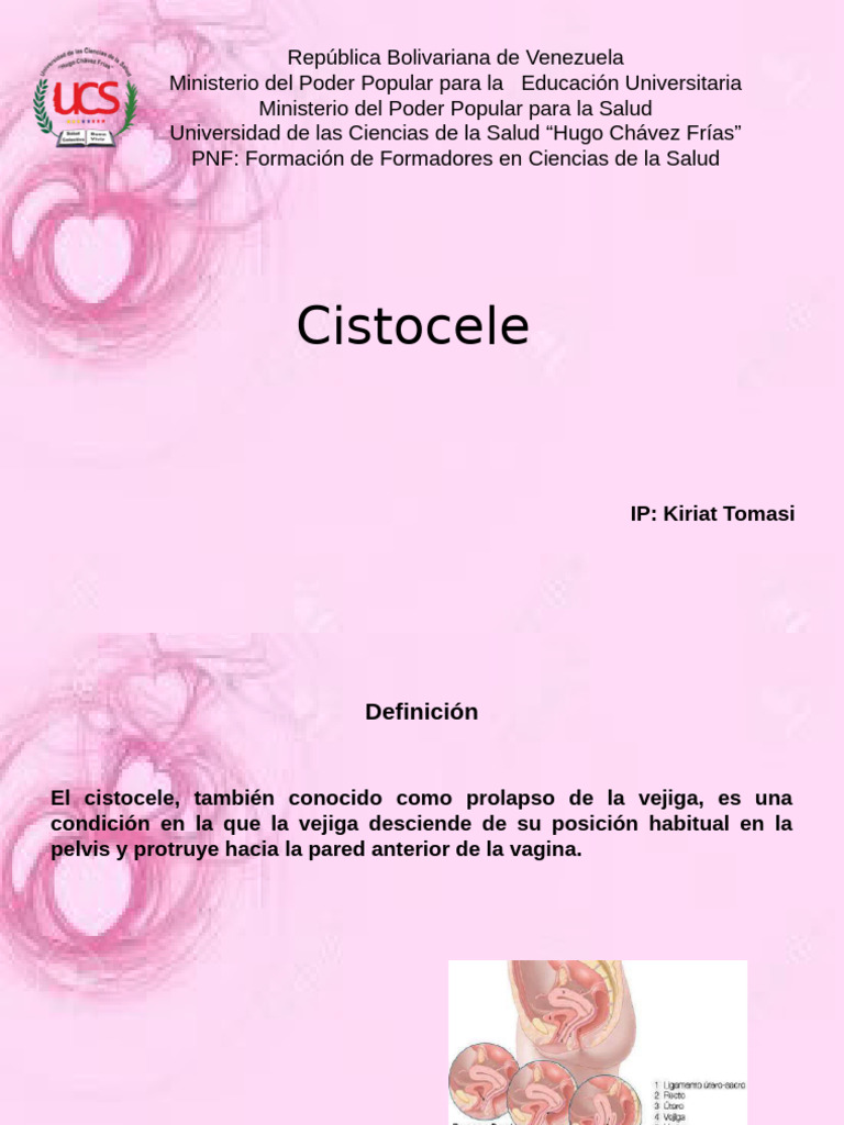 Cistocele: Fisiopatología y Causas | PDF | Causas de la muerte ...