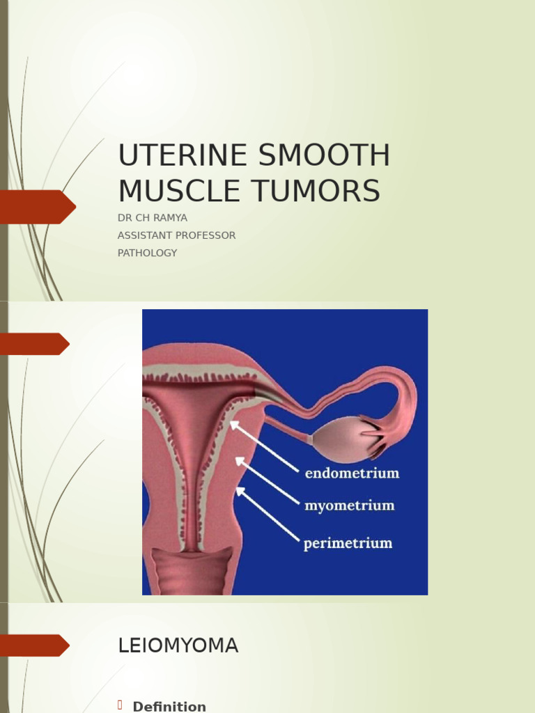 Uterine Smooth Muscle Tumors Guide | PDF | Mitosis | Cell Nucleus