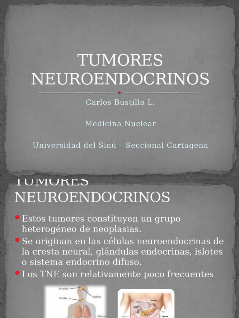 Tumoresneuroendocrinos 140519220426 Phpapp02 | PDF | Páncreas | Glándula pituitaria