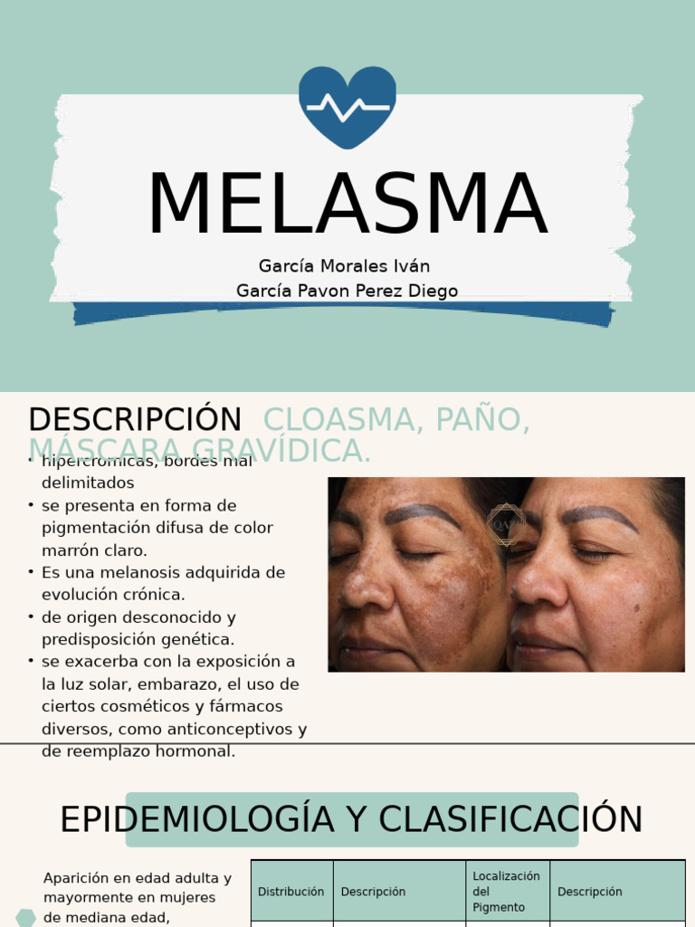 Melasma | PDF | Piel | Epidermis