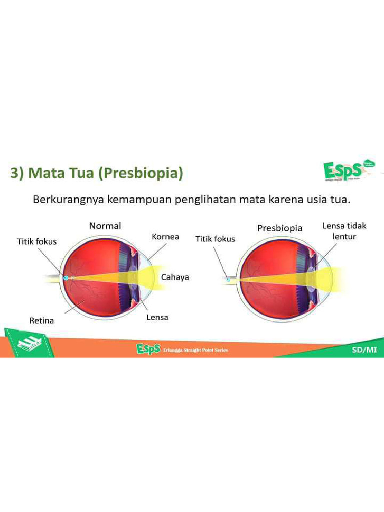 Bagian Bagian Mata | PDF