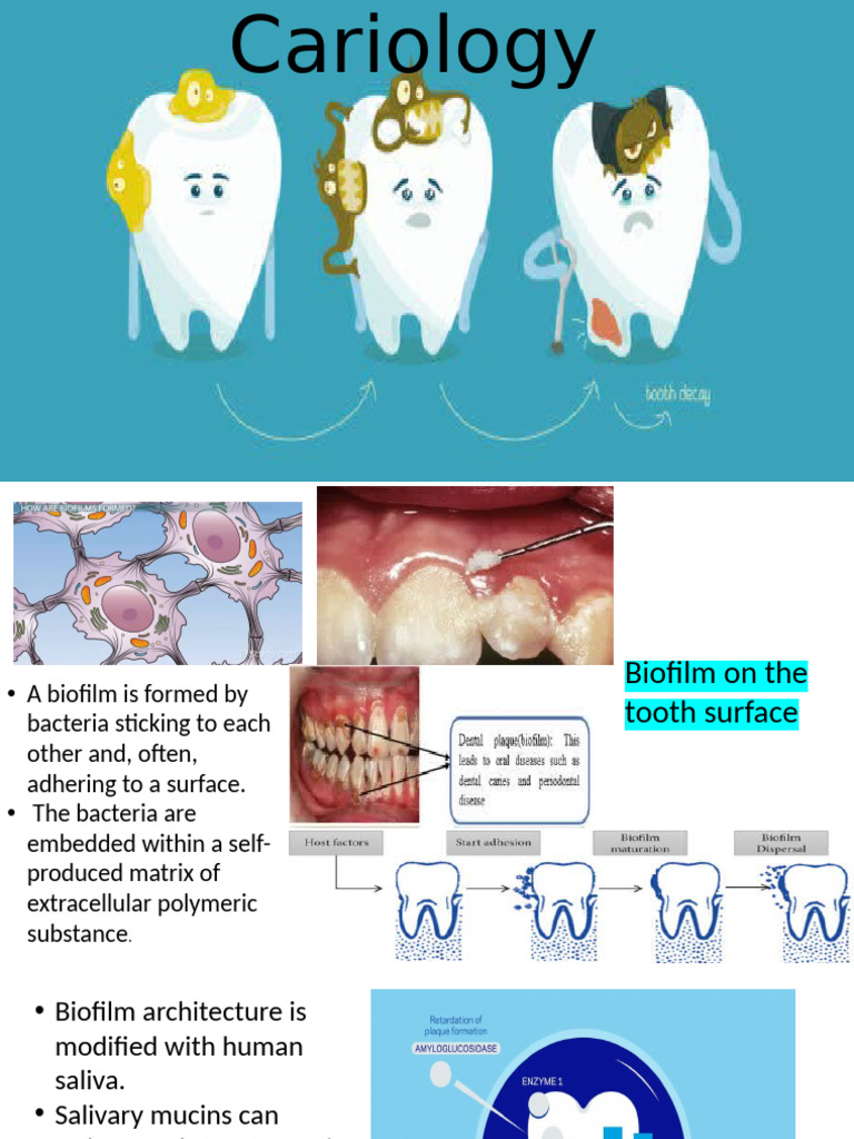 Caries Cons | PDF