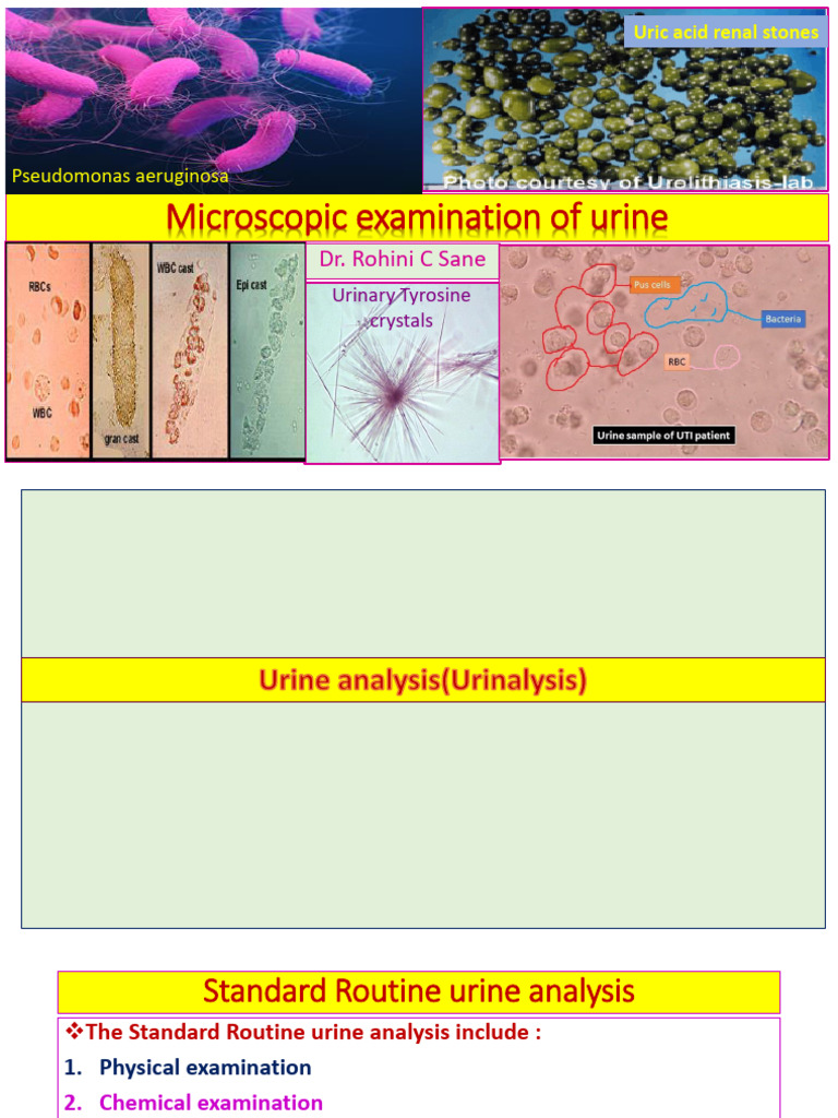 Microscopic Examination of Urine: Dr. Rohini C Sane | PDF | Kidney | Urine