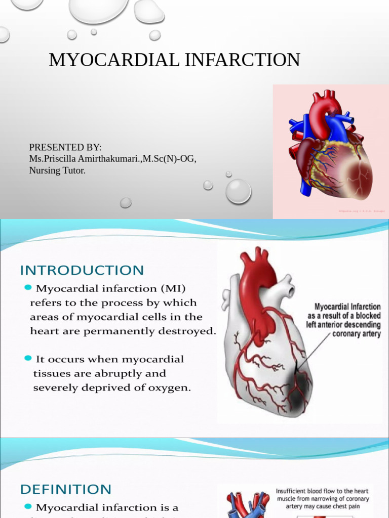 Myocardial Infarction | PDF