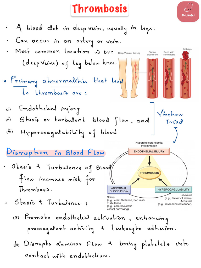 Thrombosis | PDF | Thrombosis | Coagulation