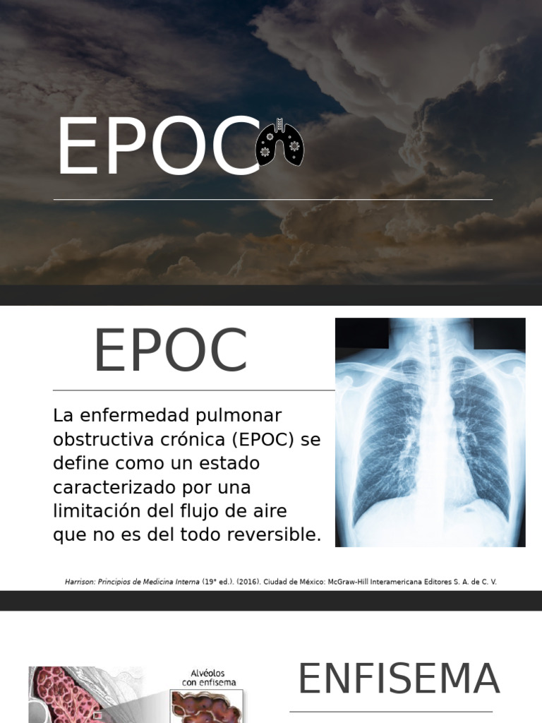 EPOC | PDF | Cáncer | Enfermedad pulmonar obstructiva crónica