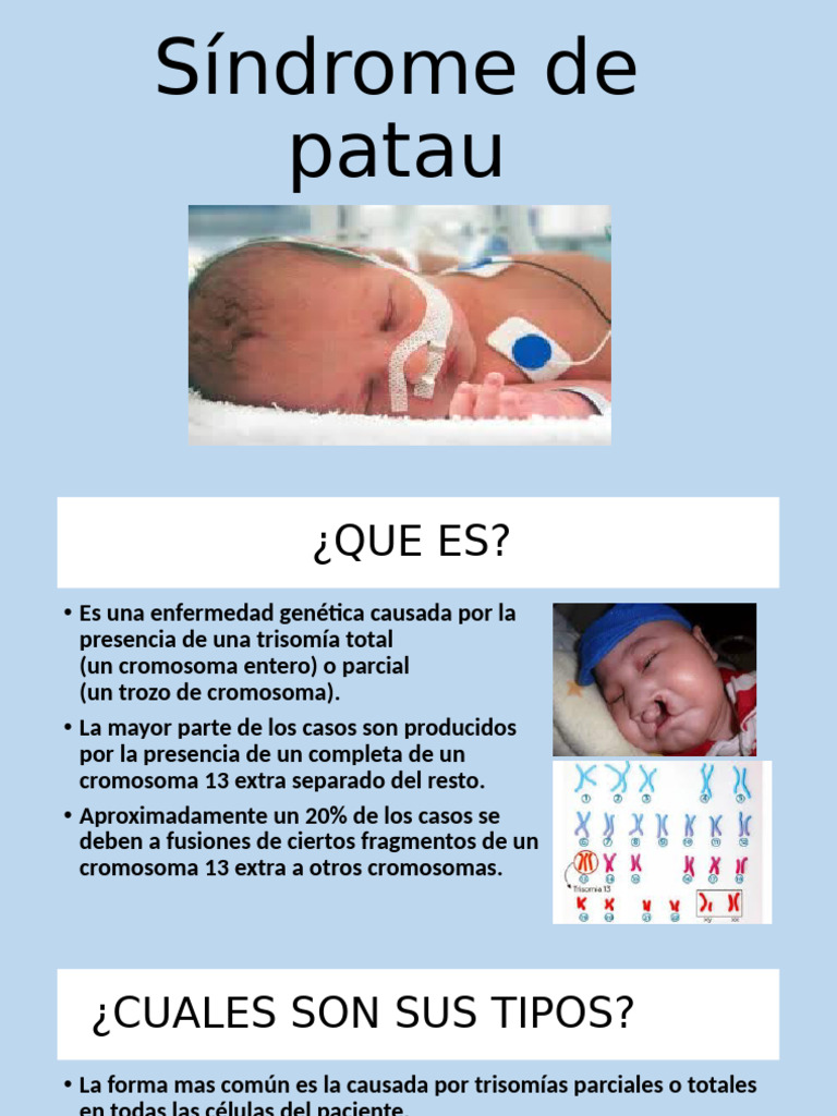 Síndrome de Patau: Trisomía 13 y Características | PDF | Salud y ...