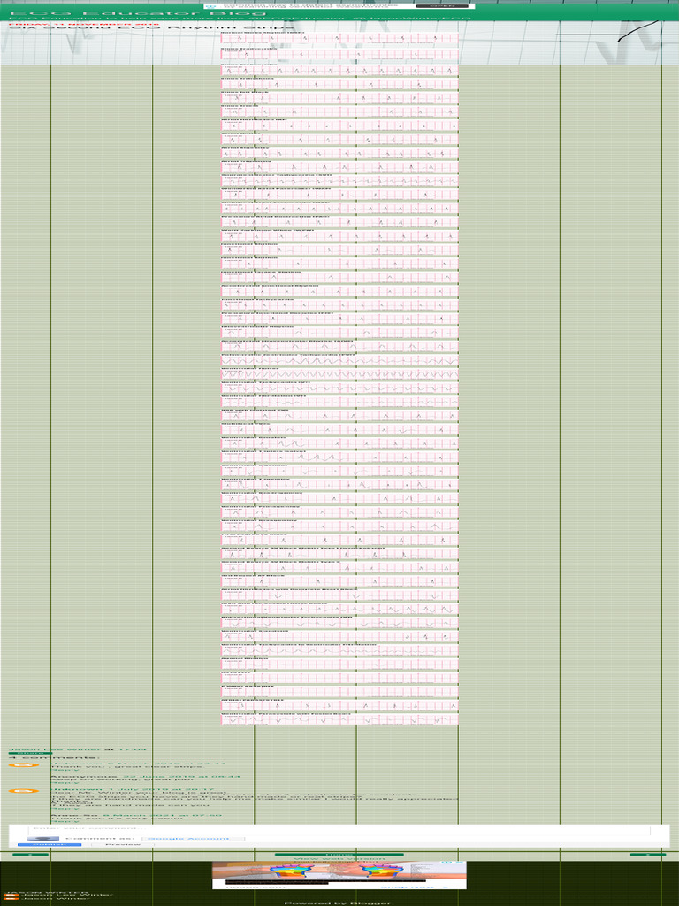 ECG Educator Blog Six Second ECG Rhythm Strips | PDF