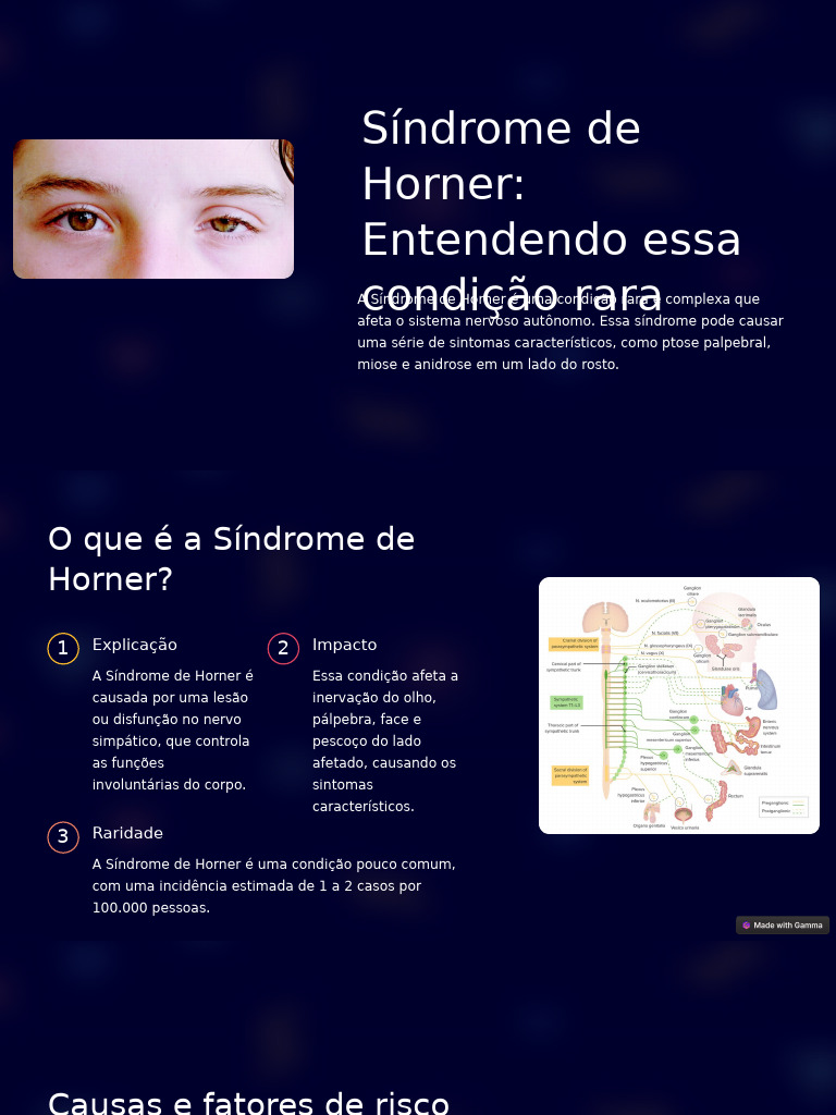 Sindrome de Horner Entendendo Essa Condicao Rara | PDF | Nervo | AVC
