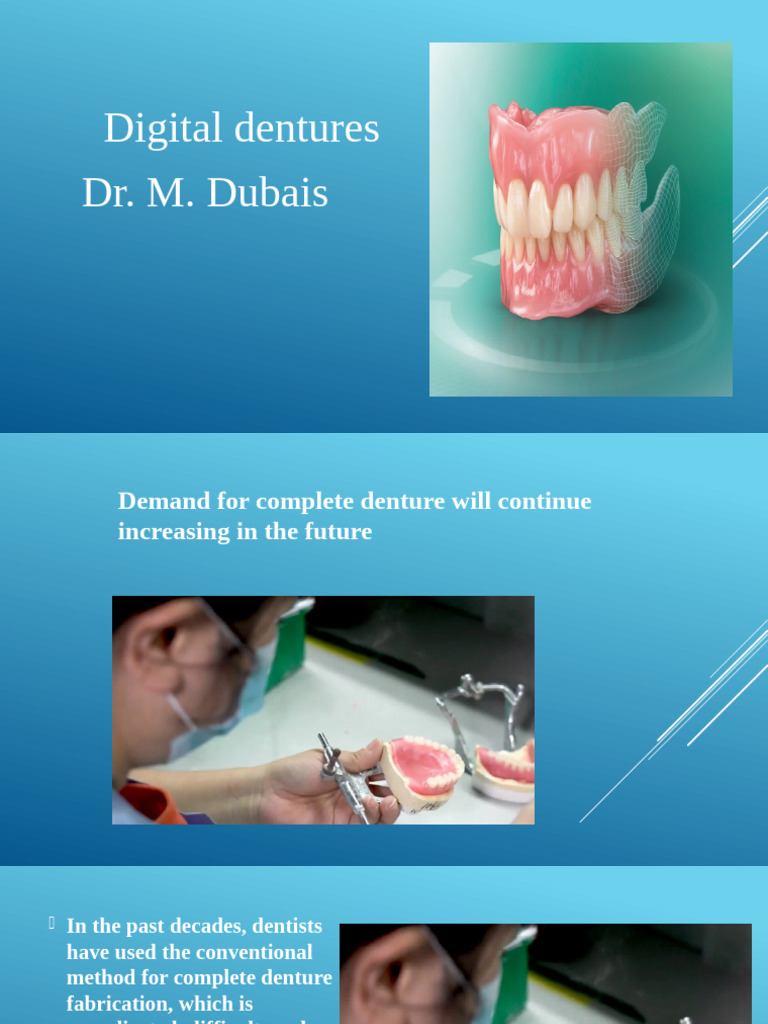 Digital Denture 1 | PDF | Dentures | 3 D Printing