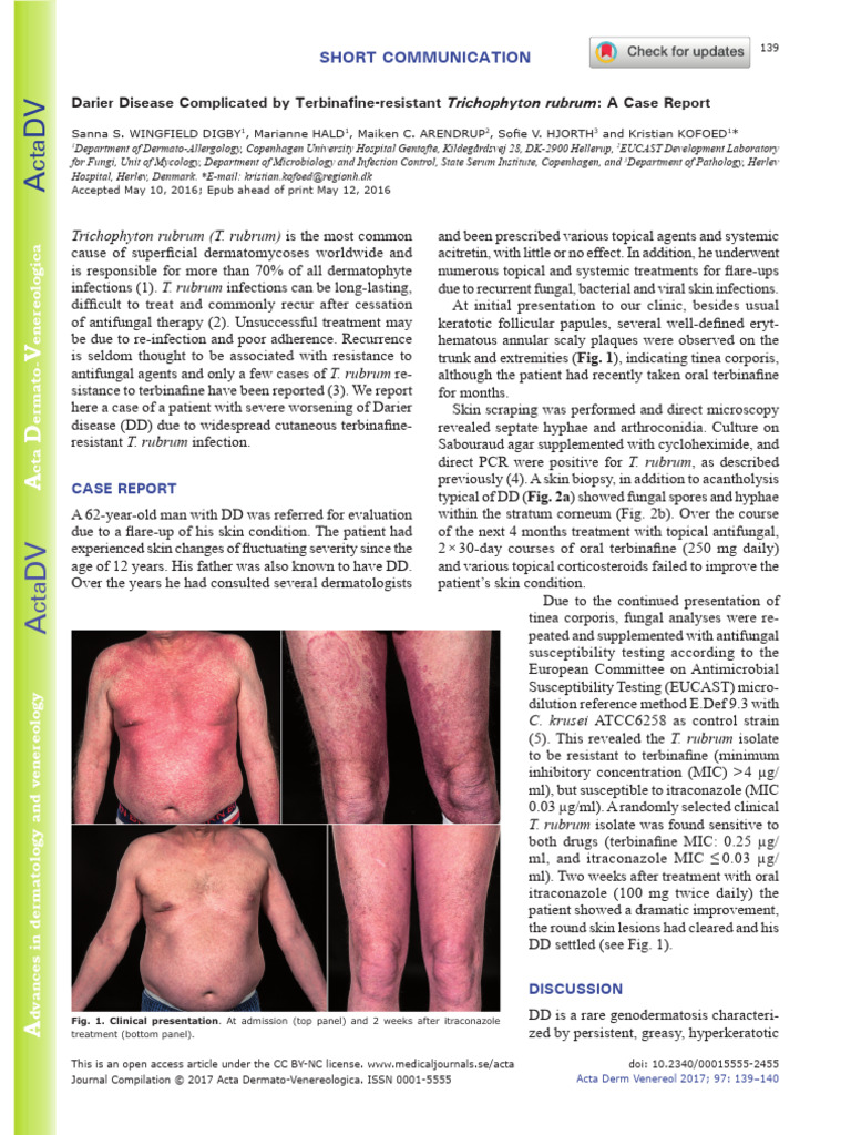 Darier Disease Complicated by Terbinafine-Resistant Trichophyton Rubrum ...