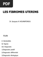 Classification FIGO Des Fibromes Utérins - Embolisation Fibrome Utérin ...