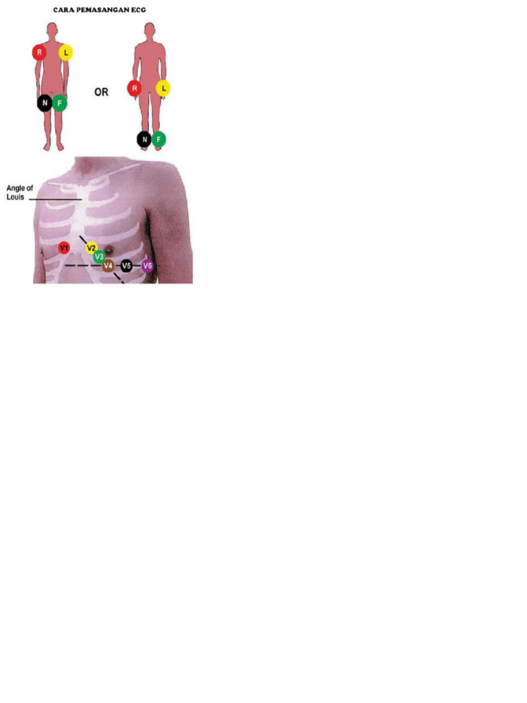 Titik Ekg | PDF