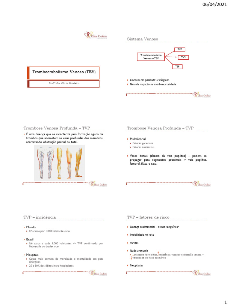 Aula 11 - Tromboembolismo Venoso - TEV | PDF | Trombose | Varizes