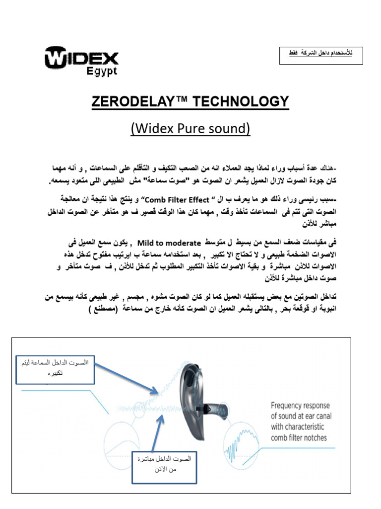 Widex Pure Sound Study 3 Pages | PDF