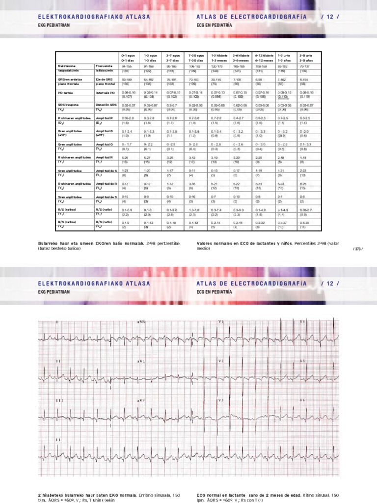 ECG pediatria | Electrocardiography | Artificial Cardiac Pacemaker