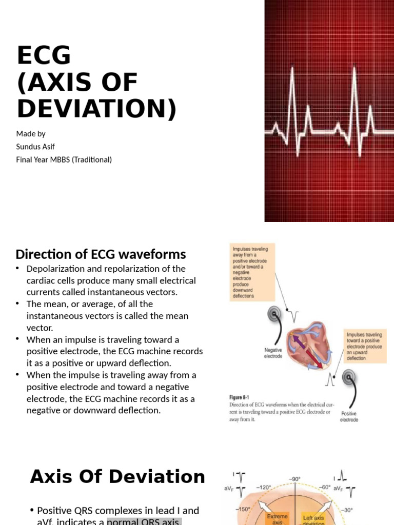 Understanding ECG Axis Deviation | PDF | Science & Mathematics