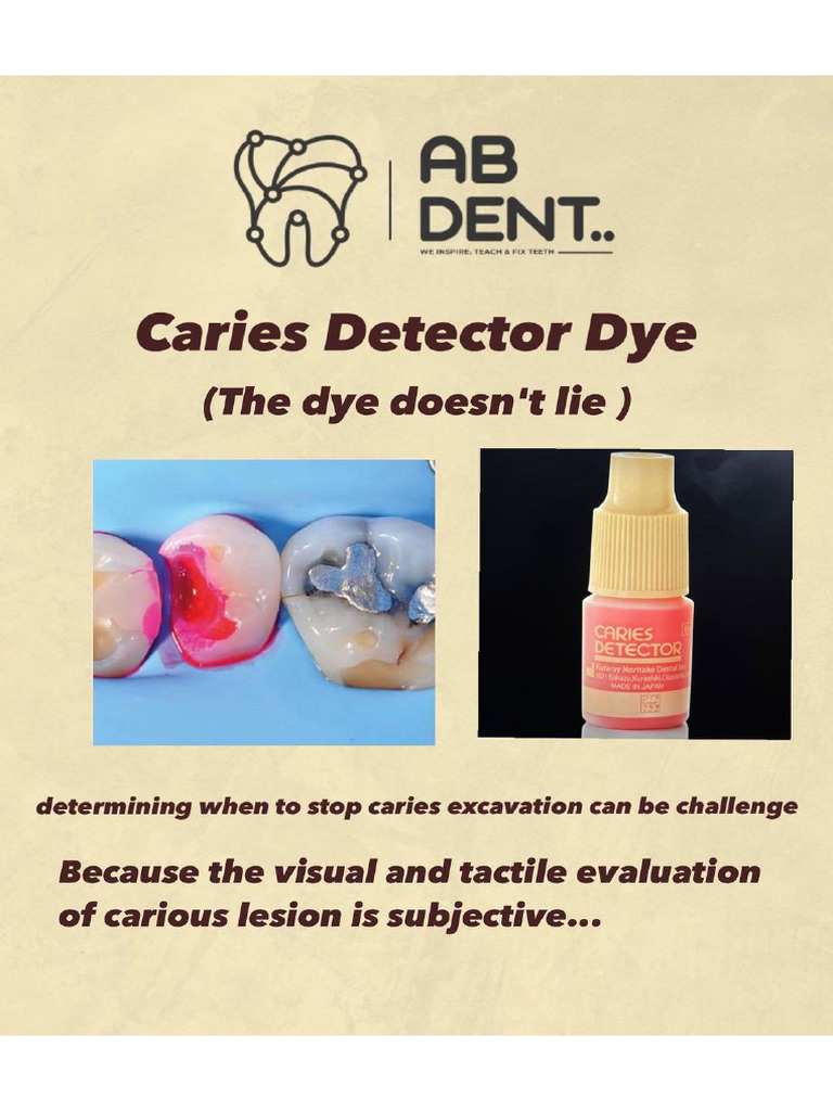Caries Detector Dye | PDF