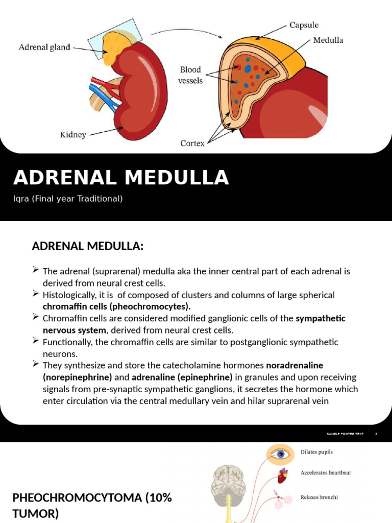 Adrenal Medulla Disease by IQRA | PDF | Adrenal Gland | Clinical Medicine