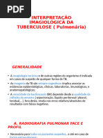 Manejo da Tuberculose Ganglionar | PDF | Tuberculose | Imagiologia médica