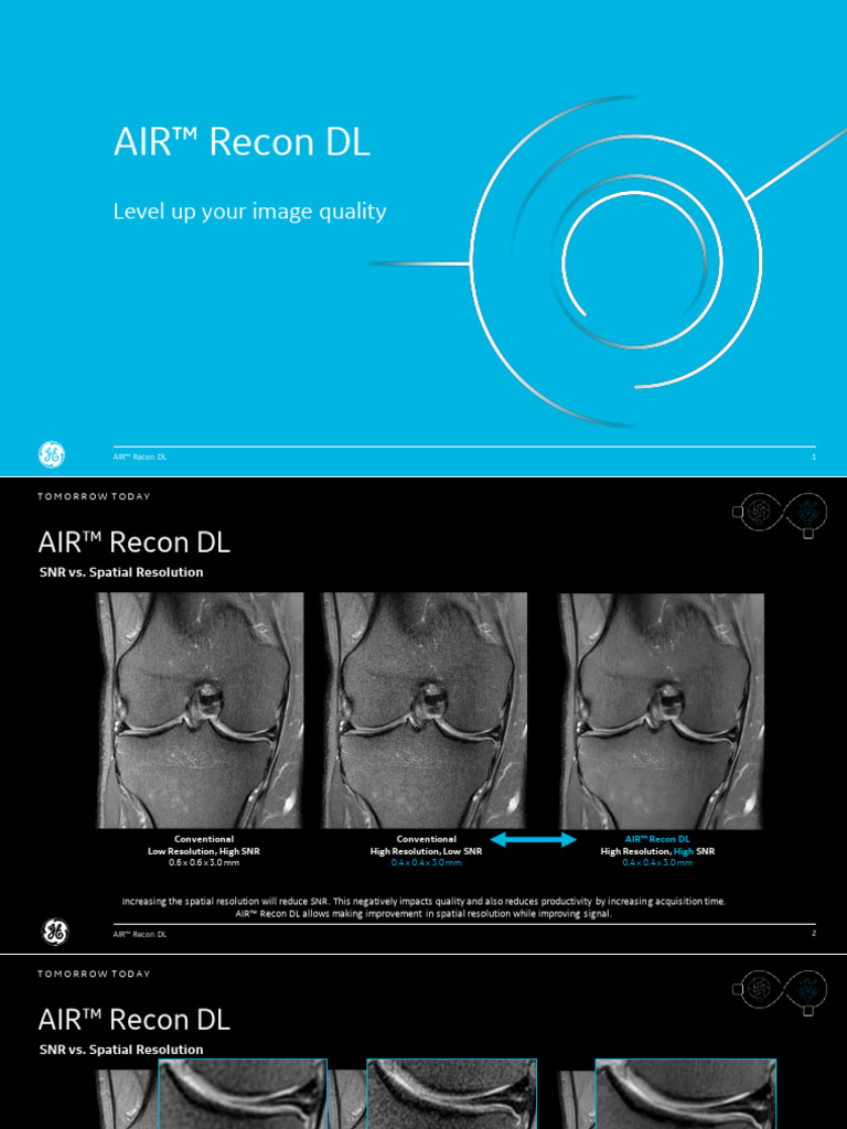 AIR Recon DL Image Gallery | PDF | Signal To Noise Ratio | Vertebral Column