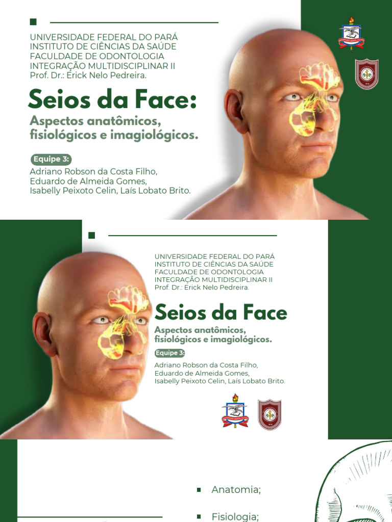 Seios Da Face PDF | PDF | Imagiologia médica | Medicina Clínica