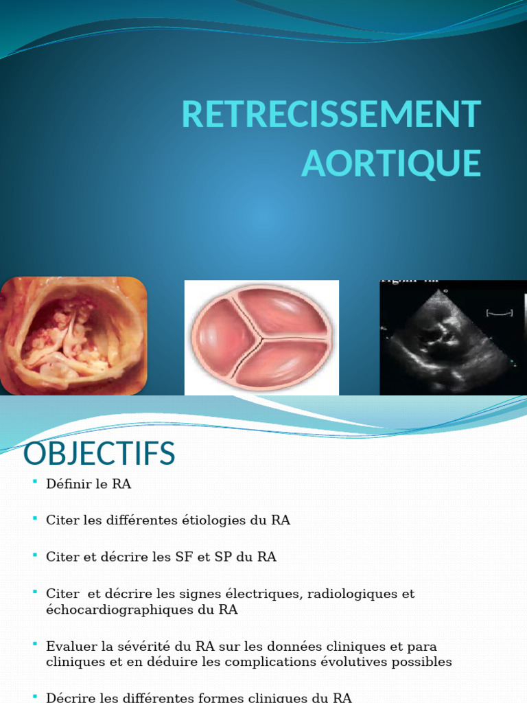 Rétrécissement Aortique | PDF | Insuffisance cardiaque | Maladies et troubles