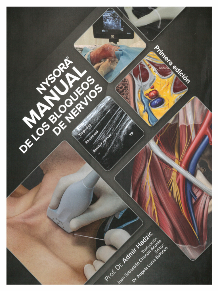 NYSORA Manual de Los Bloqueos de Los Nervios Admir Hadzic Angela | PDF