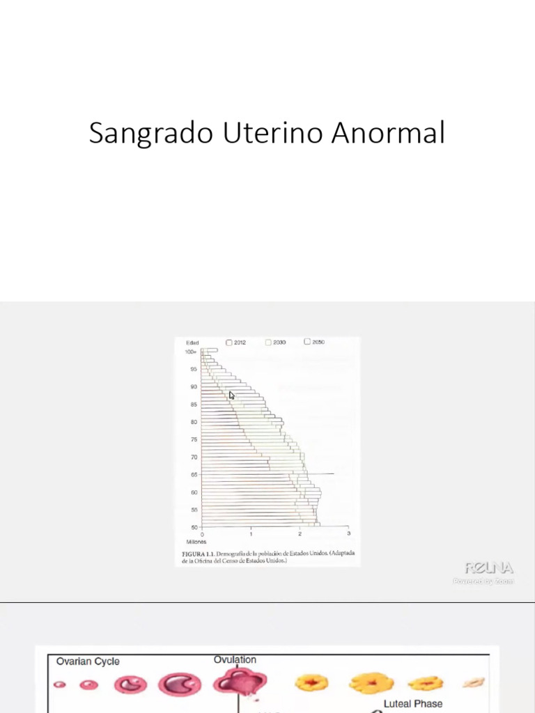 Sangrado Uterino Anormal: Causas e Tratamentos | PDF