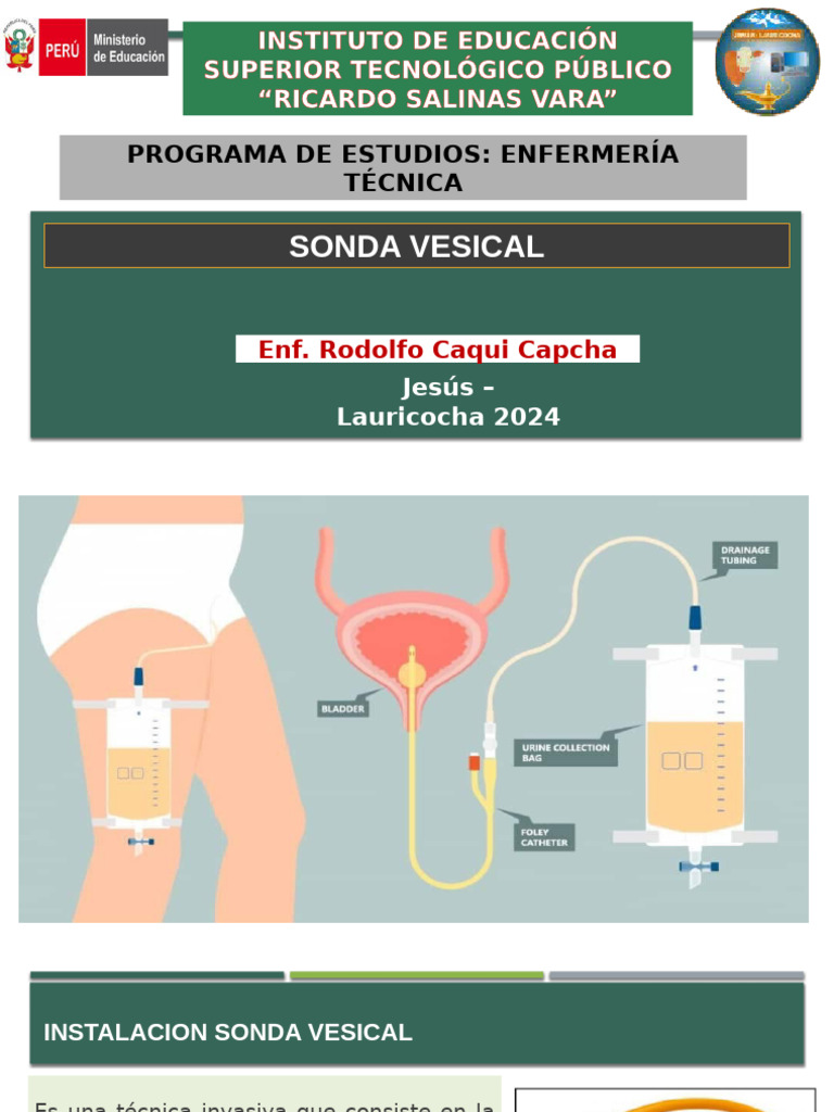 Sondaje Vesical | PDF | Ciencia y matemáticas