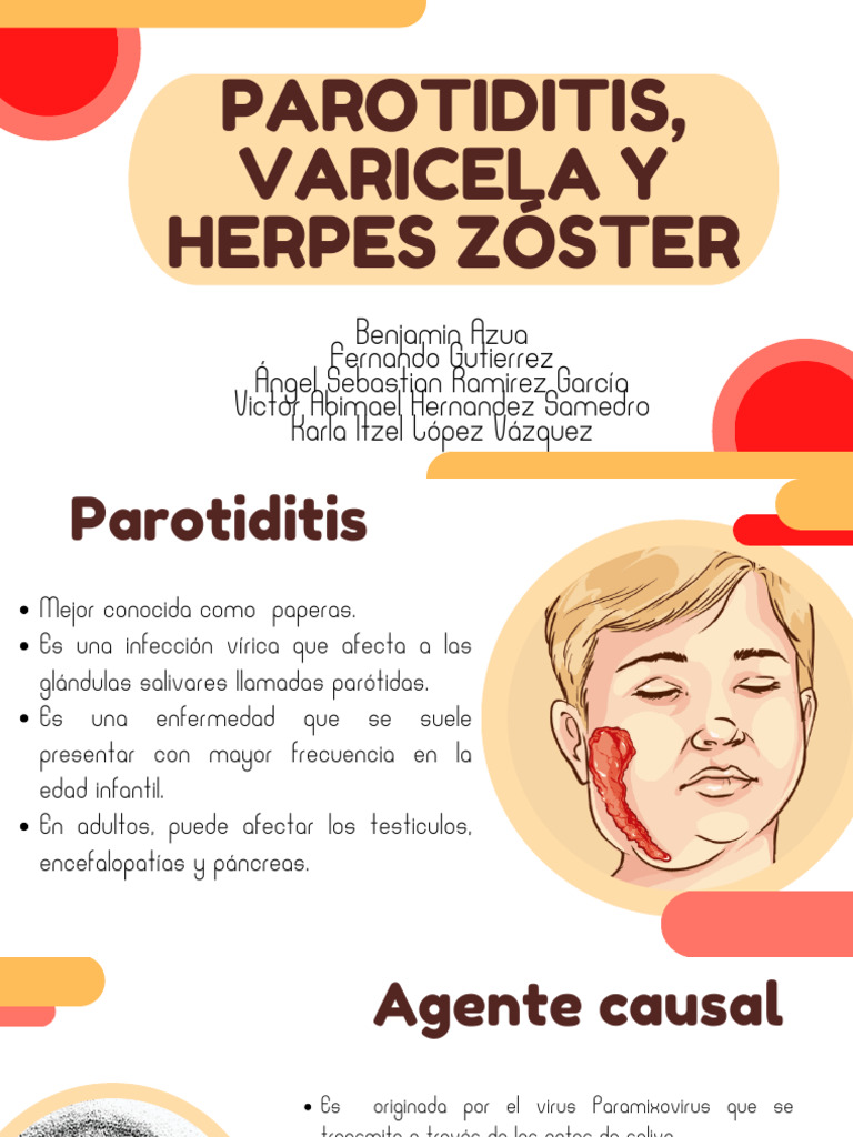 Parotiditis, Varicela y Herpes Zóster: Guía Clínica | PDF | Virus ...