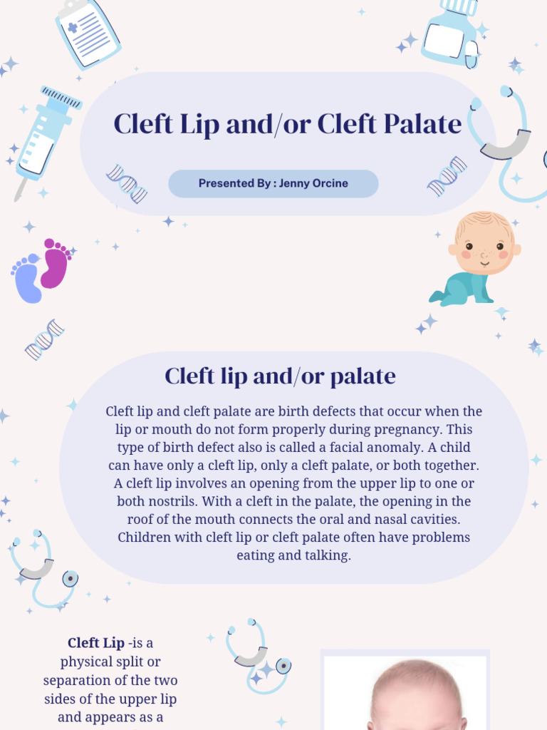 Understanding Cleft Lip and Palate | PDF | Breastfeeding | Medical ...
