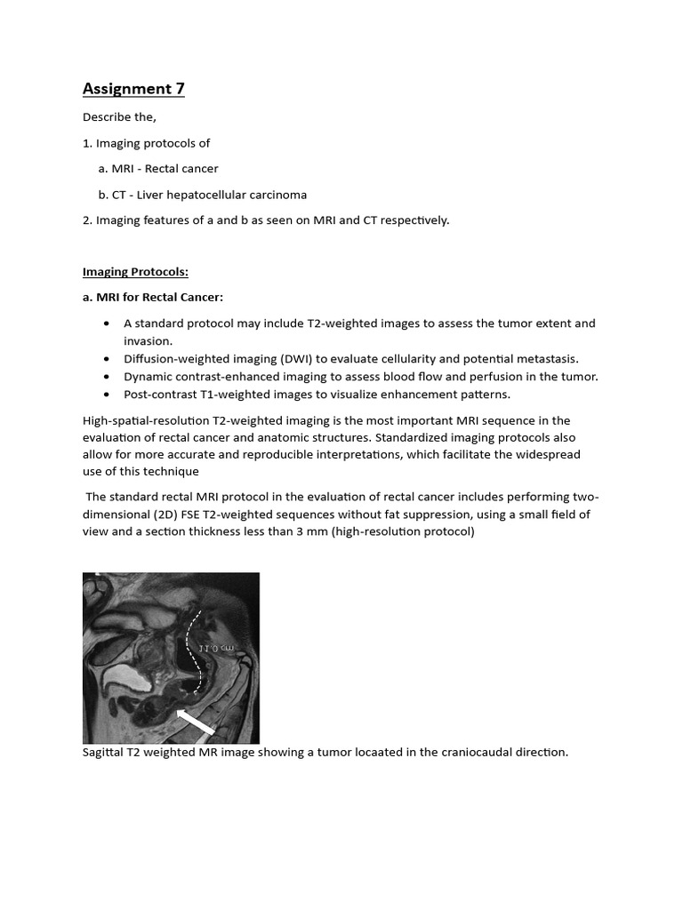 Assignment 7 ICSD II | PDF | Magnetic Resonance Imaging | Ct Scan