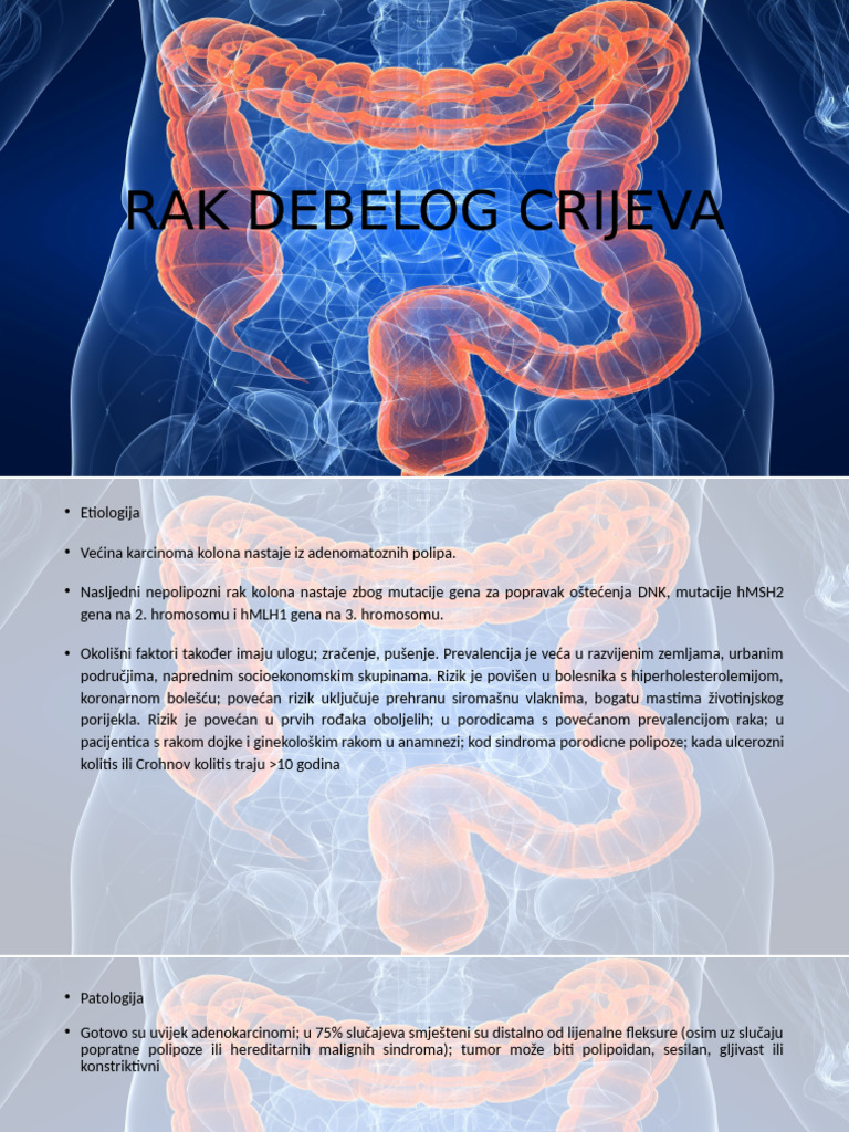 Rak Debelog Crijeva - 9ee6a9ad 8611 439d b8bb Aa0f4edeb567 | PDF