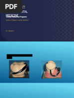 Lec 11 Clasp Assembly | PDF | Mouth | Dentistry Branches