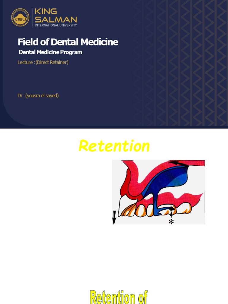 Understanding Direct Retainers in Dentistry | PDF