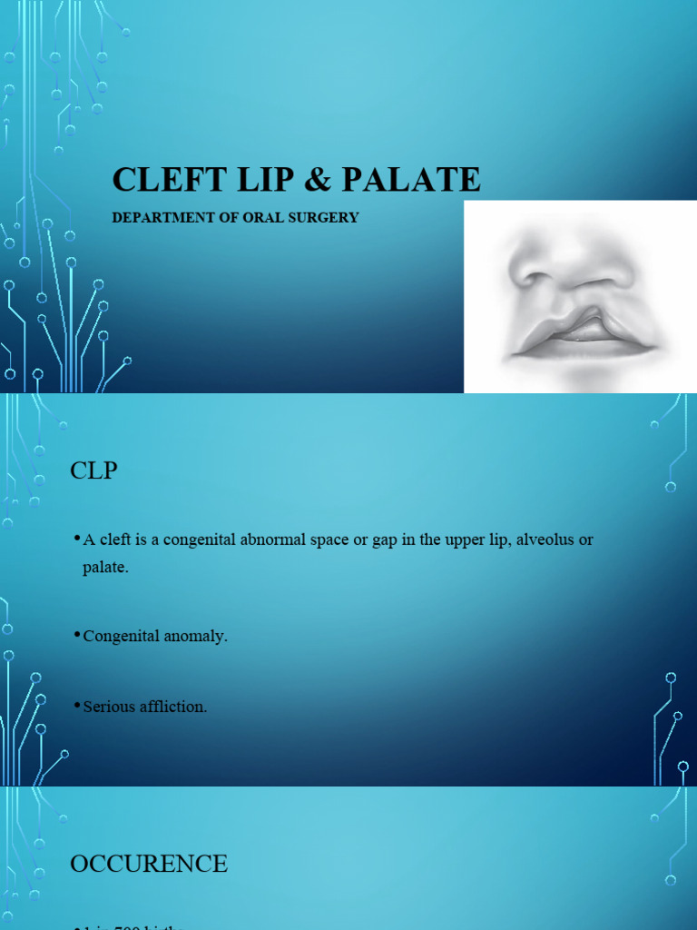 5.Cleft Lip & Palate | PDF | Human Nose | Diseases And Disorders