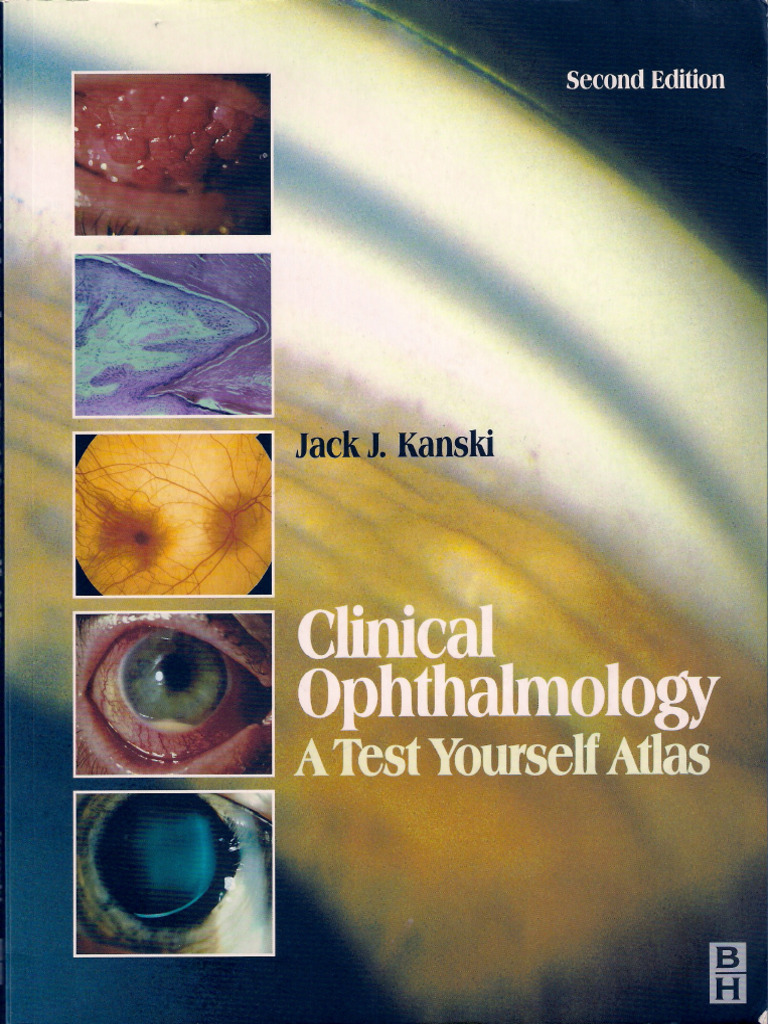 Clinical Ophthalmology A Test Yourself A | PDF | Human Eye | Ophthalmology