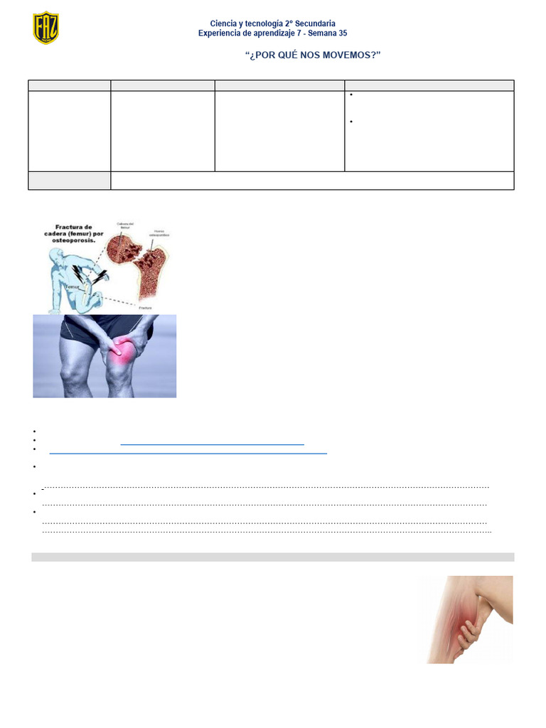 Actividad 5-U7 | PDF | Fibromialgia | Articulación