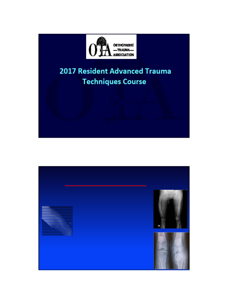 Malunion Watson | PDF | Anatomical Terms Of Location | Knee