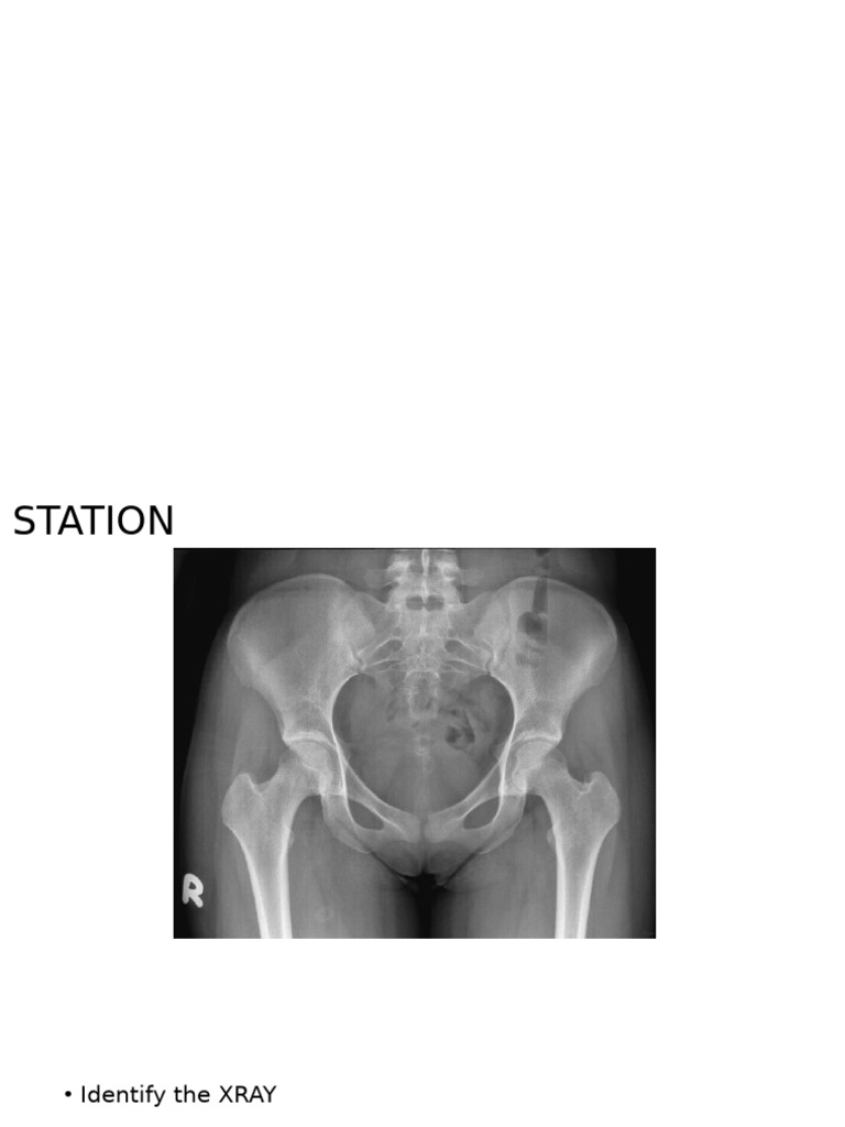 For DR Malik Wasim Corrected | PDF | Skeletal System | Medical Specialties