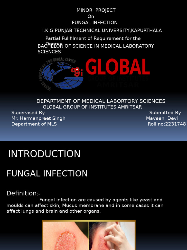 Comprehensive Guide to Fungal Infections | PDF | Infection | Fungus