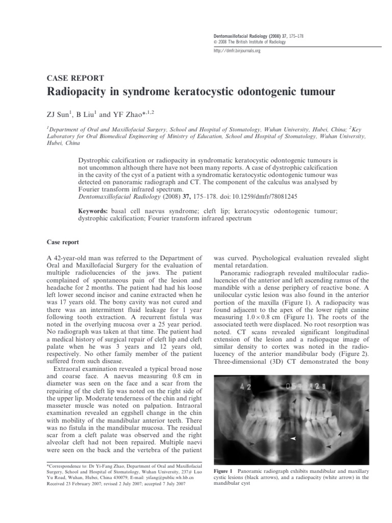 Radiopacity in Syndrome Keratocystic Odontogenic Tumour | PDF | Medical ...