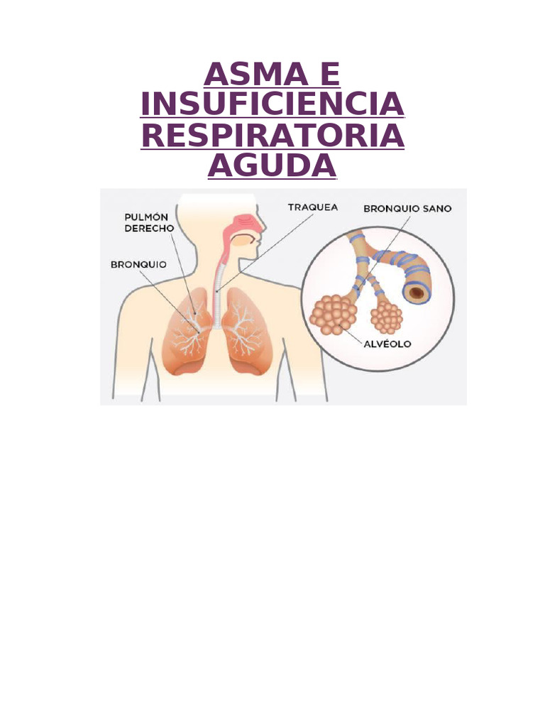 Asma e Insuficiencia Respiratoria Aguda | PDF | Asma | Mitocondria